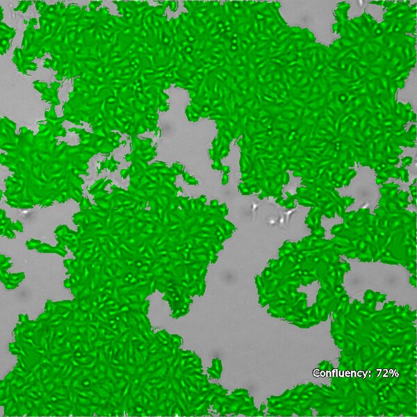 sBT-RMS Spontaneous Brain-tropic RET Melanoma-sorted Mouse Cell Line ...